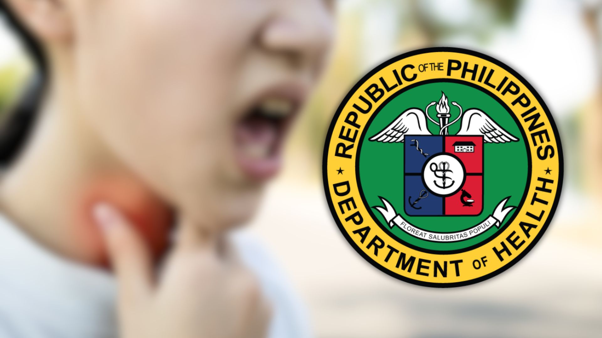 DOH appeals family to bring watusi patient back to hospital